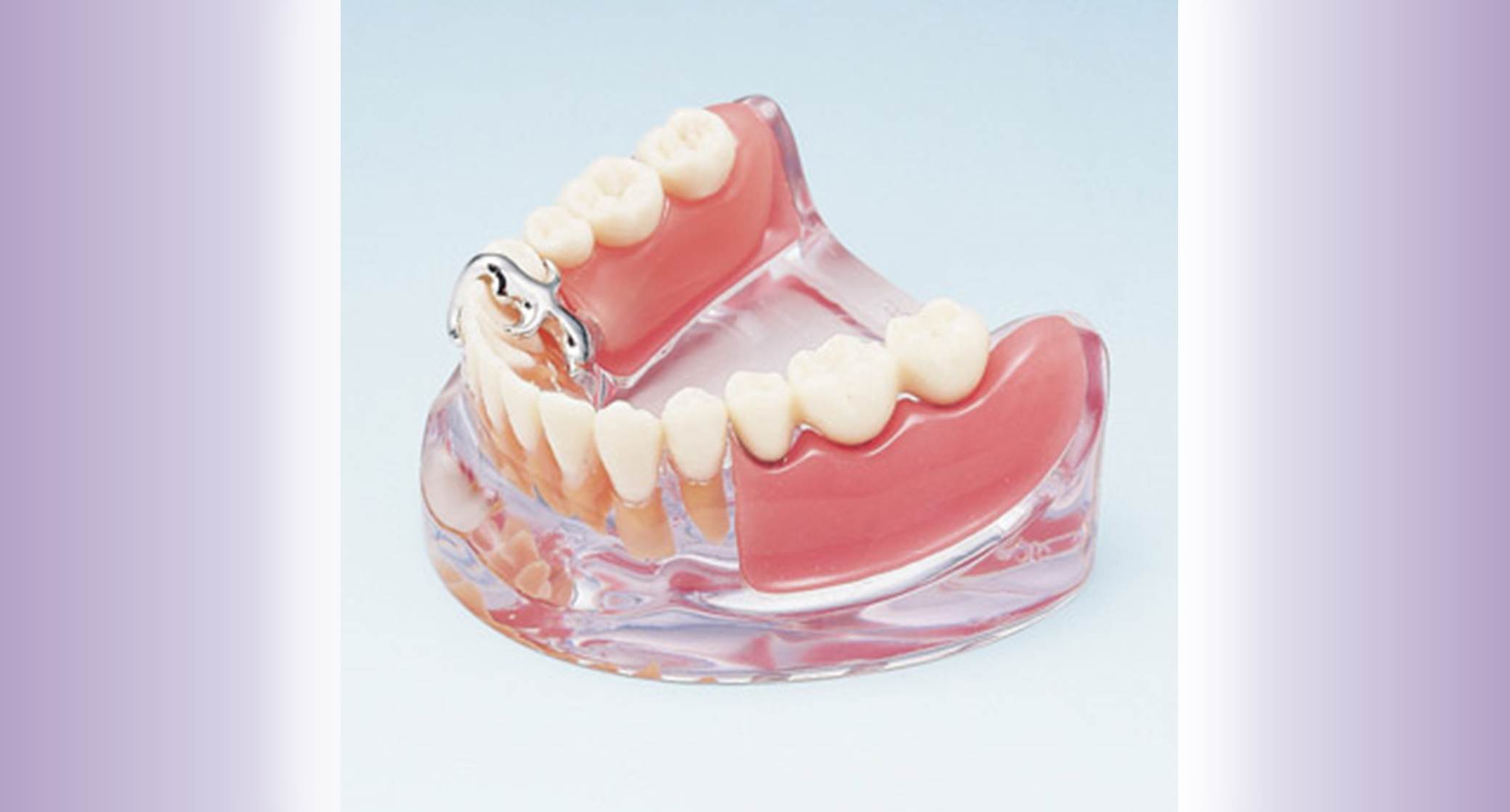 Implants widget - Phantom Head Dental